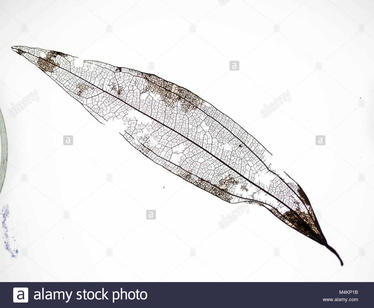 Anastomosis Stock Photos & Anastomosis Stock Images - Alamy