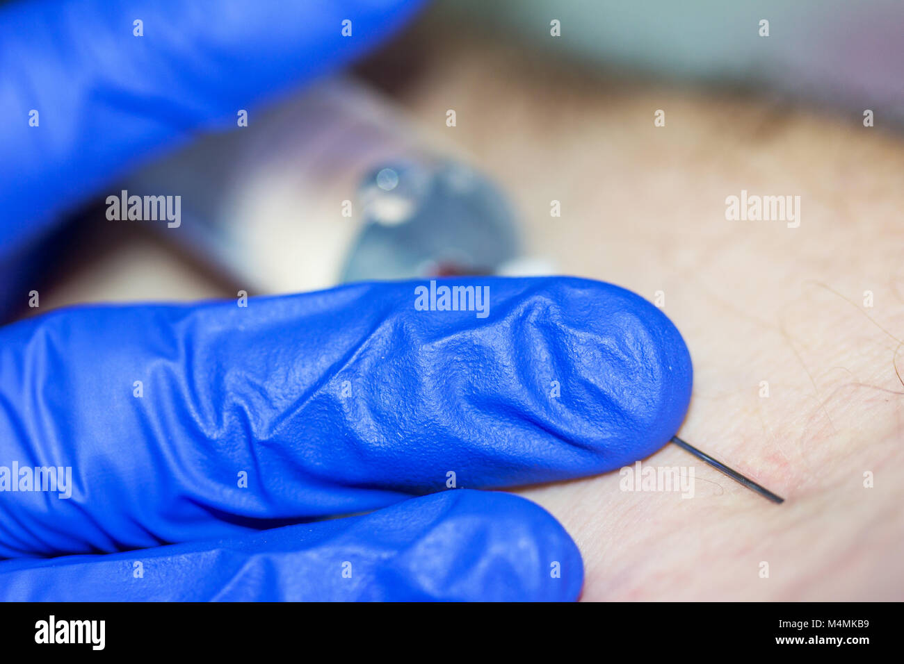 the nurse enters with a syringe injected intravenously in man hand ...