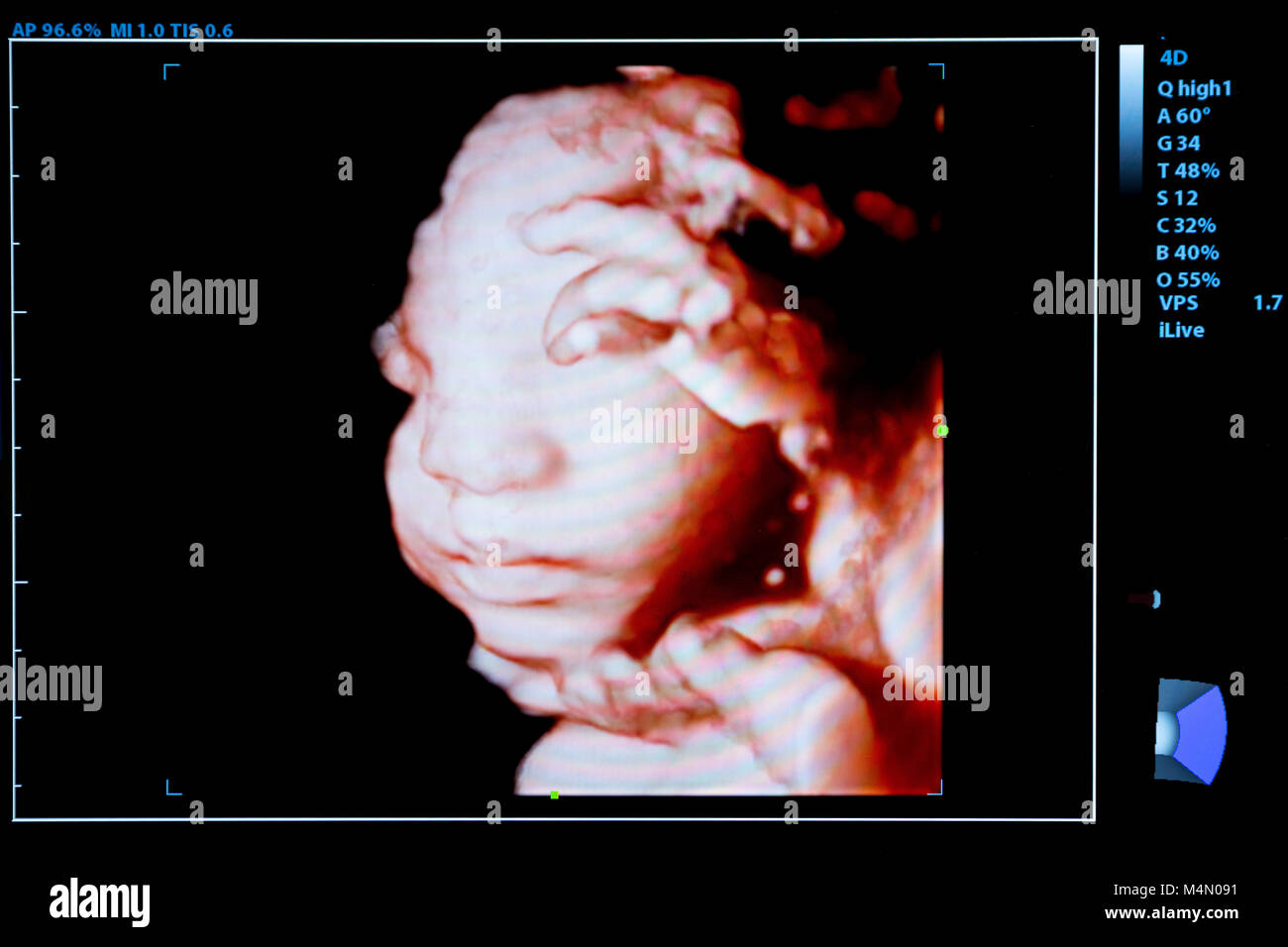 Colourful image of modern ultrasound monitor. Ultrasonography machine ...