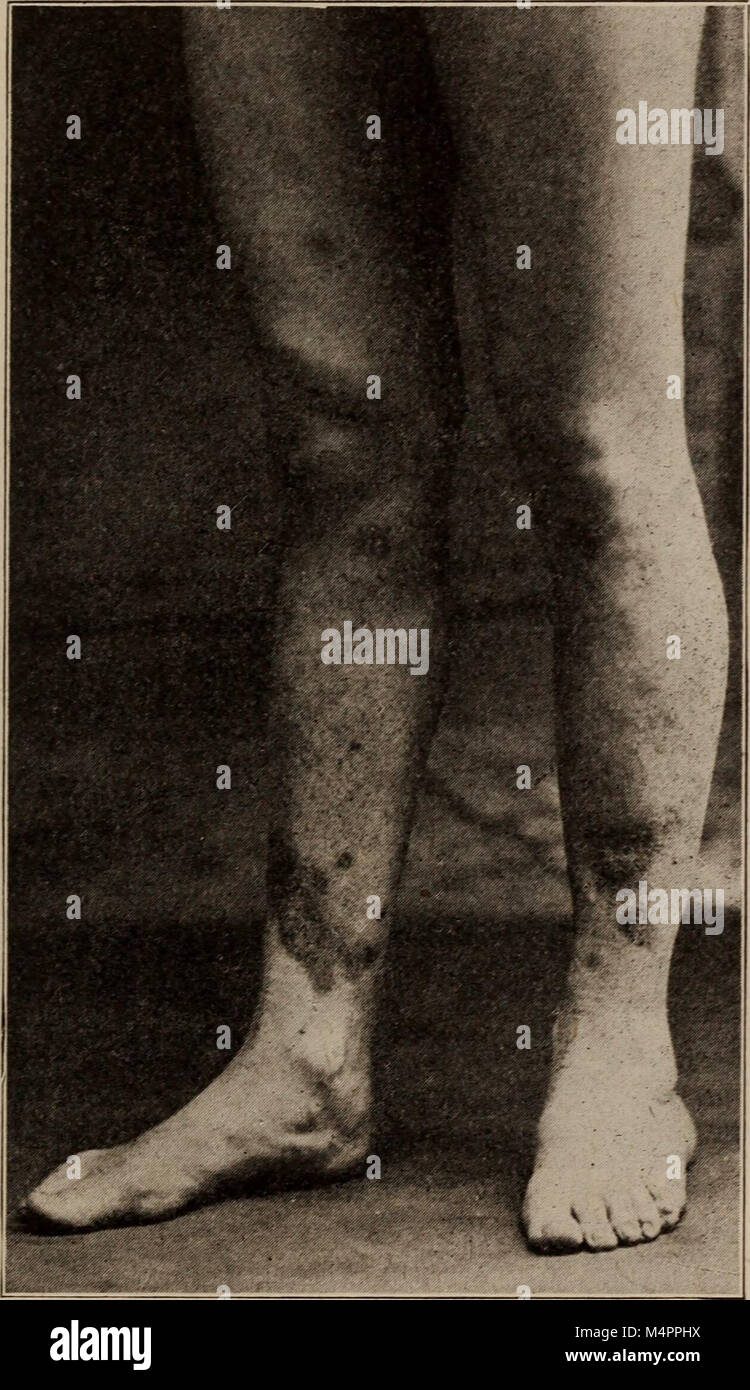 The 1913 edition of the Buffalo Medical Journal features medical ...