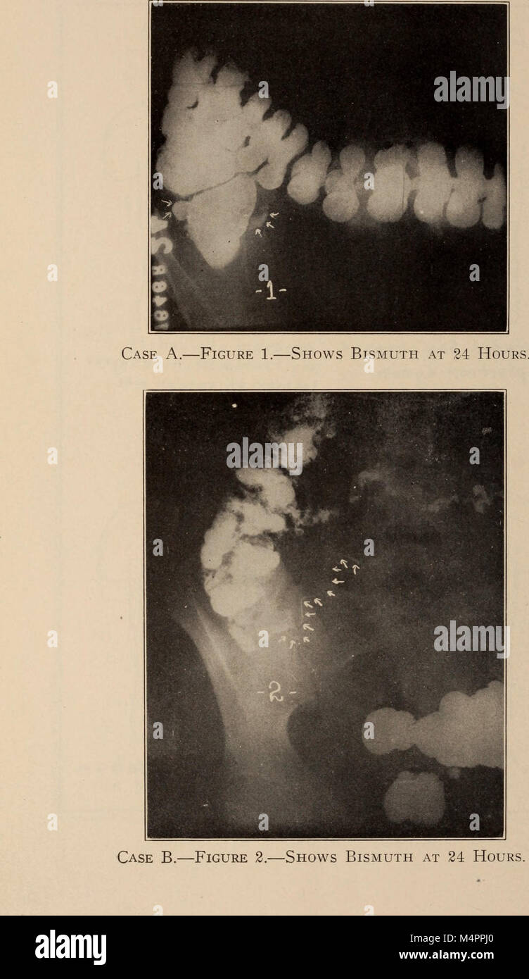 Buffalo medical journal (1913) (14763738502 Stock Photo - Alamy