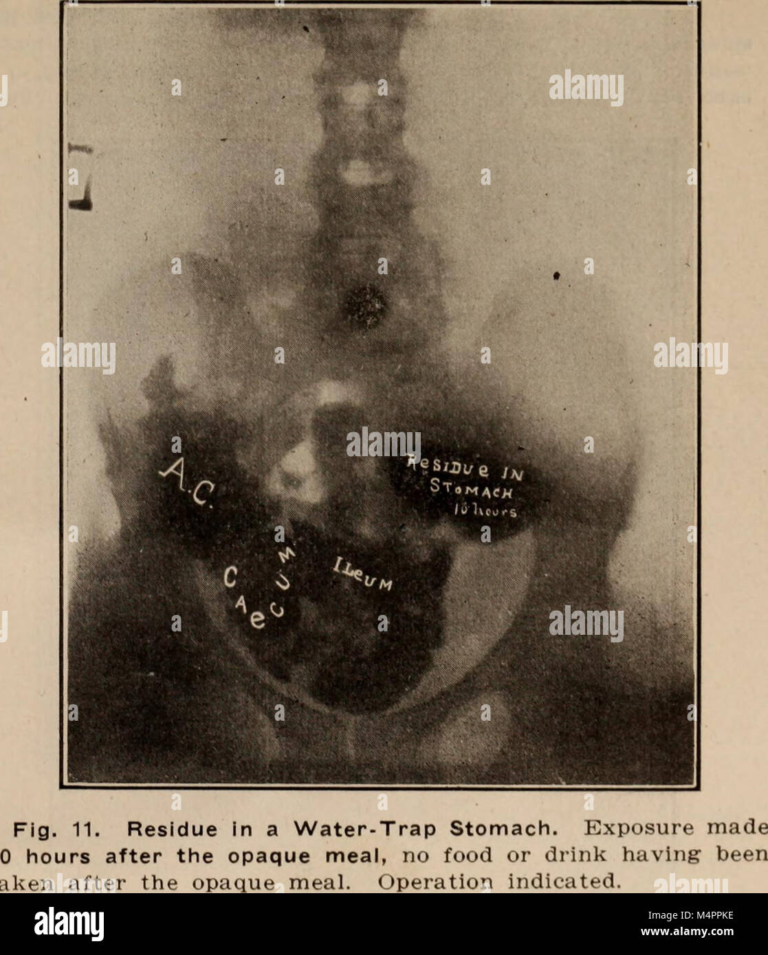 The 1914 edition of the Buffalo Medical Journal features a variety of ...