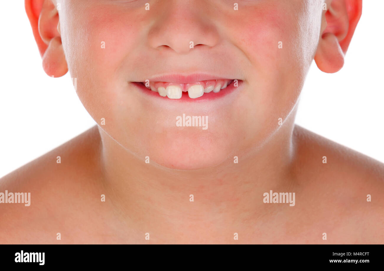 Child with big new teeth smiling isolated on a white background Stock ...