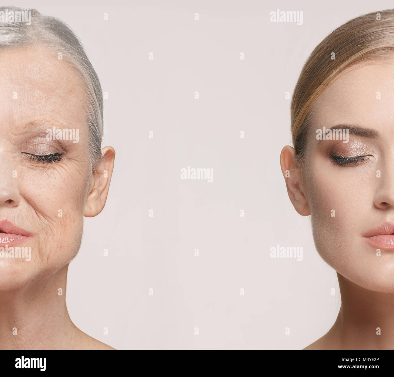 Comparison. Portrait of beautiful woman with problem and clean skin ...