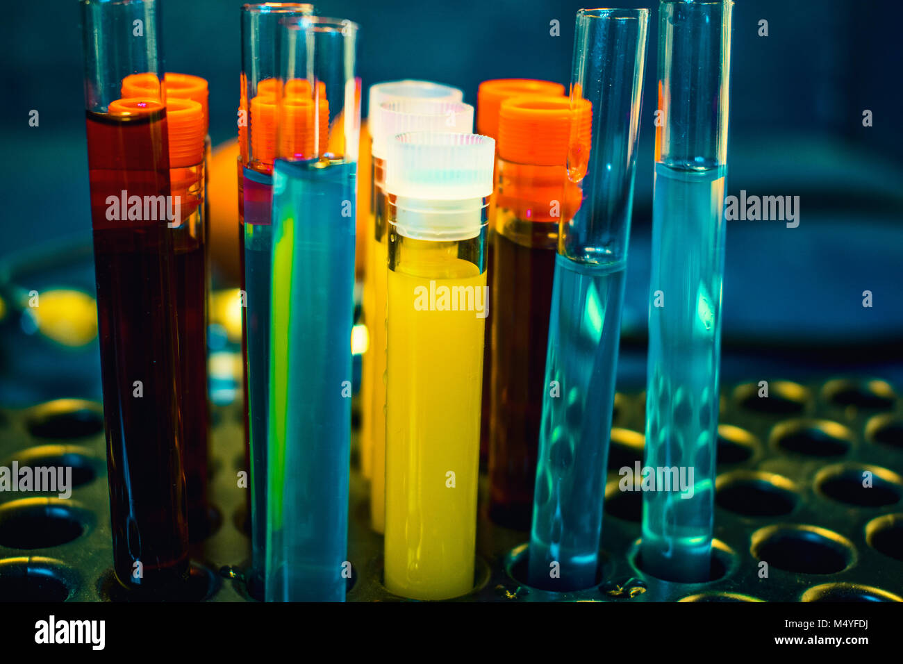 laboratory glassware test tubes IVF fertilization fertility treatment ...