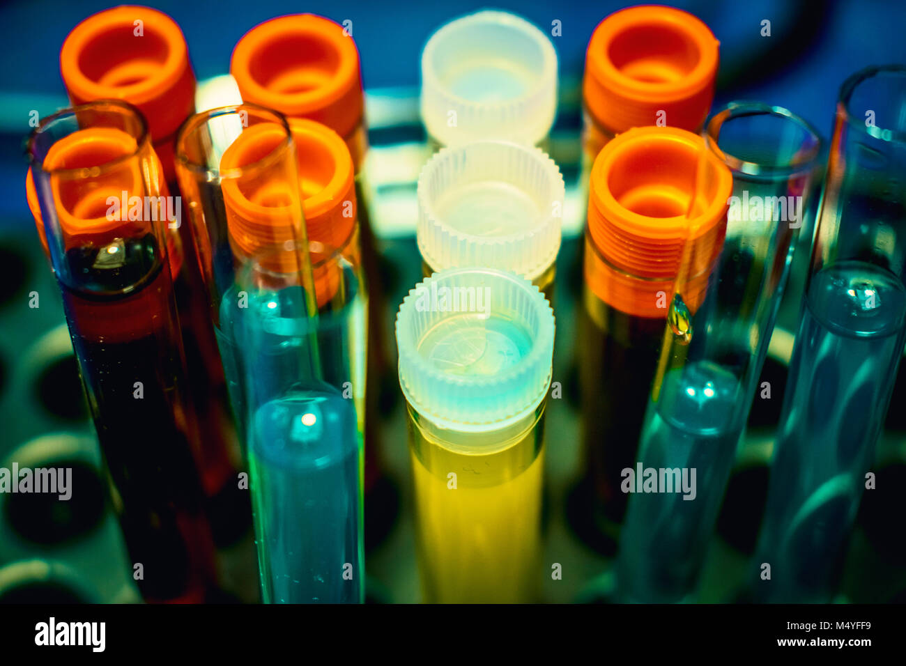 laboratory glassware test tubes IVF fertilization fertility treatment ...