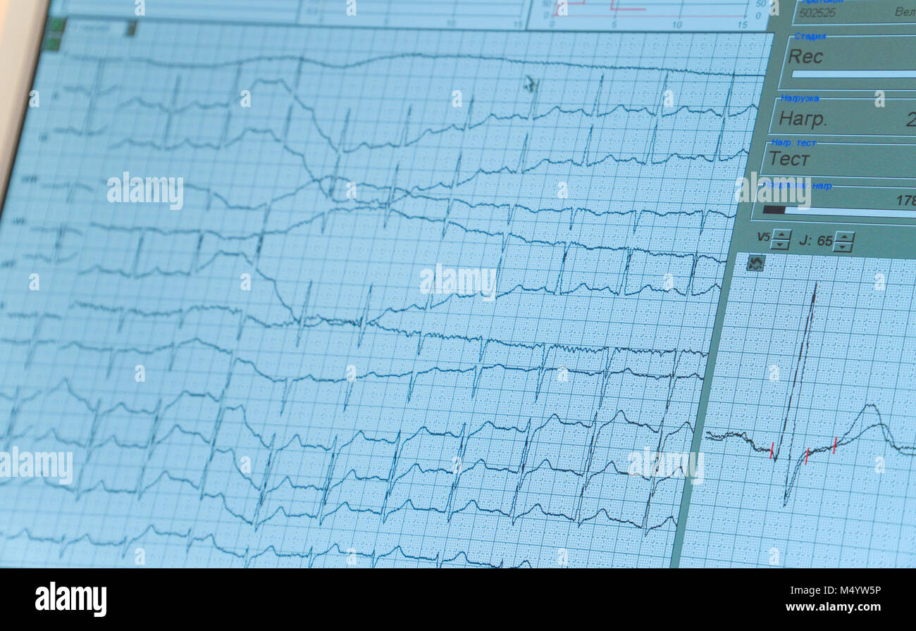 Ecg monitor screen hi-res stock photography and images - Alamy