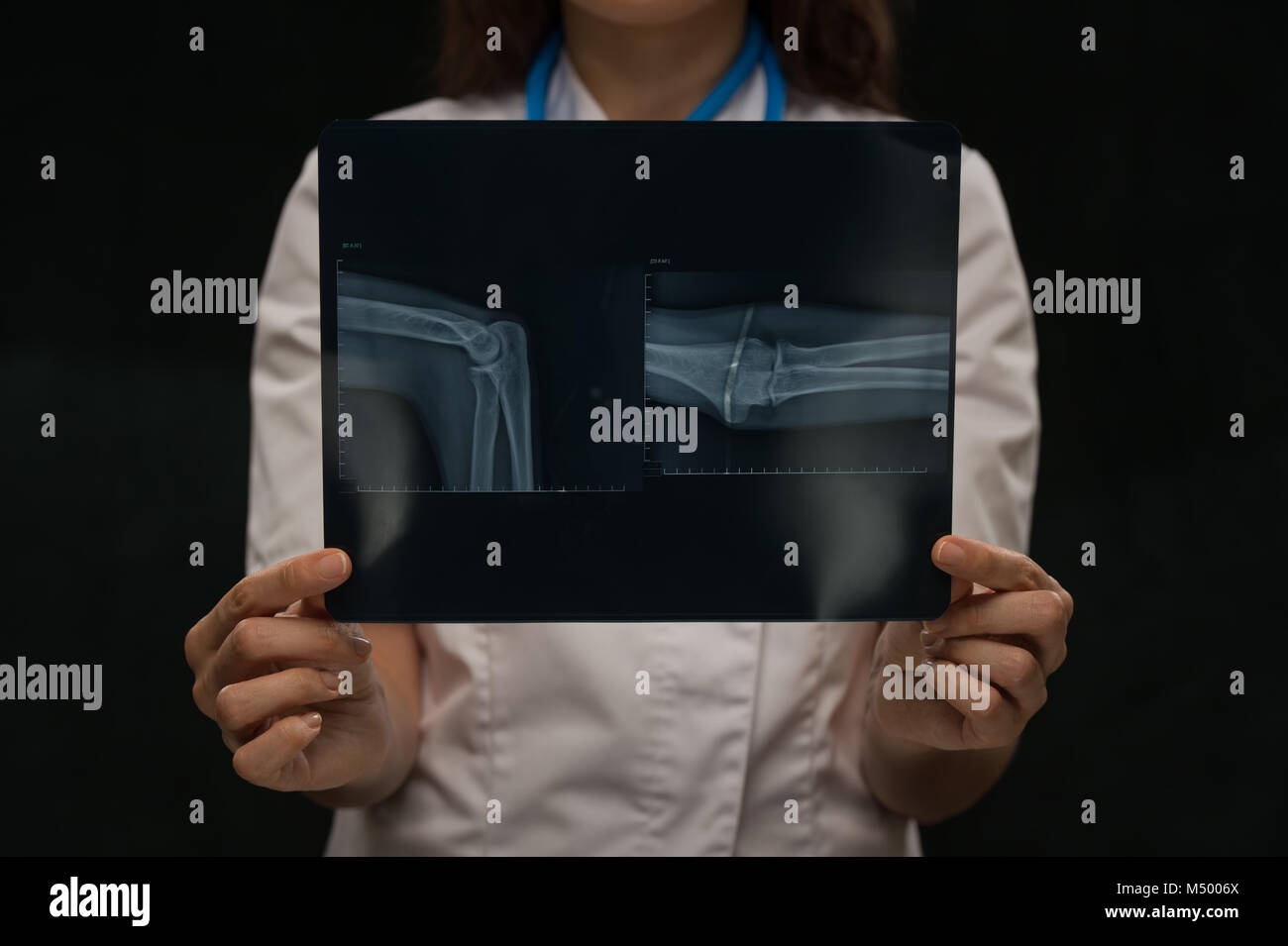 Doctor examining a arm bones radiography Stock Photo - Alamy