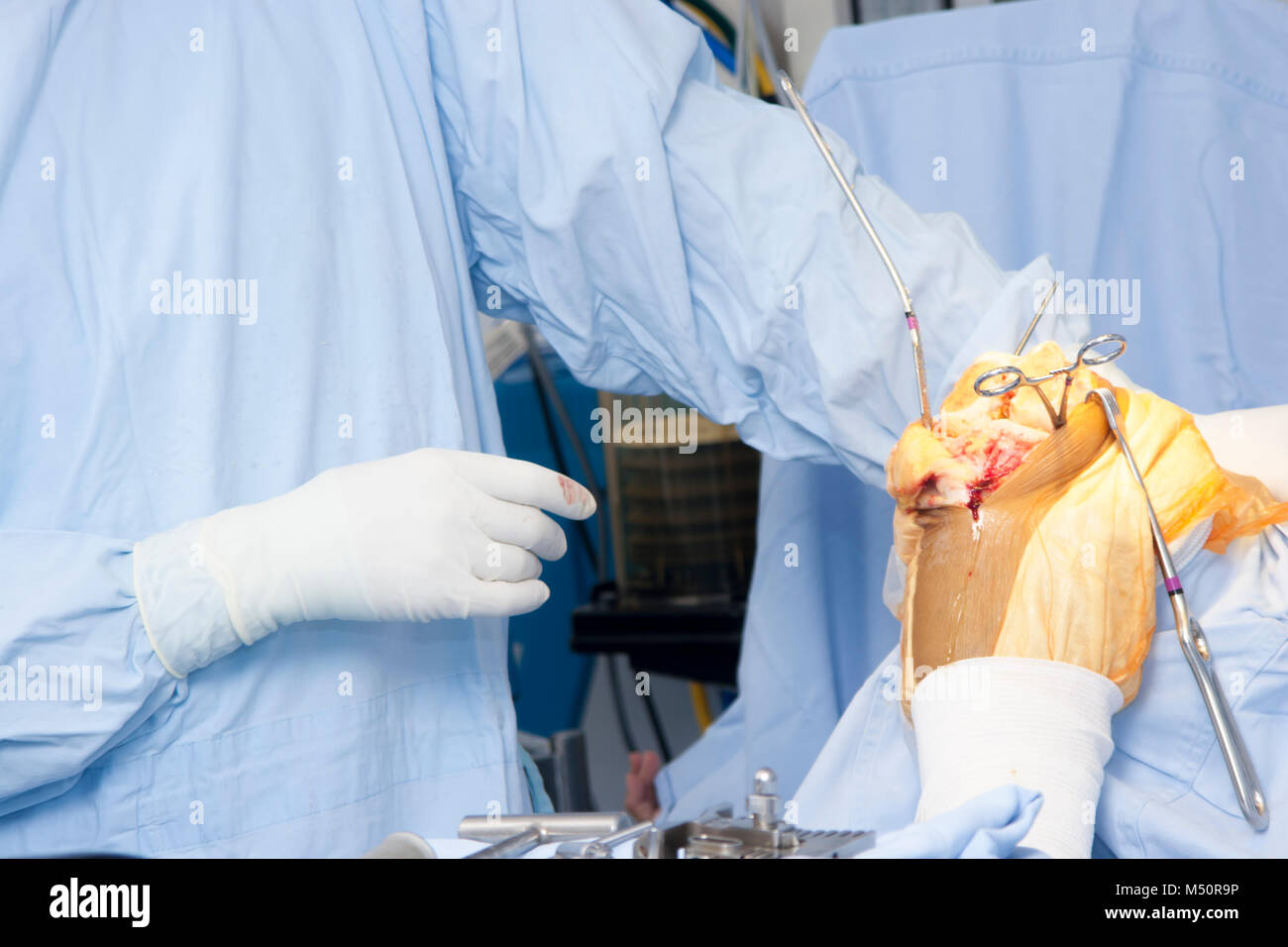 Detail of Surgery, Orthopedic Operation, Knee Surgery Stock Photo - Alamy