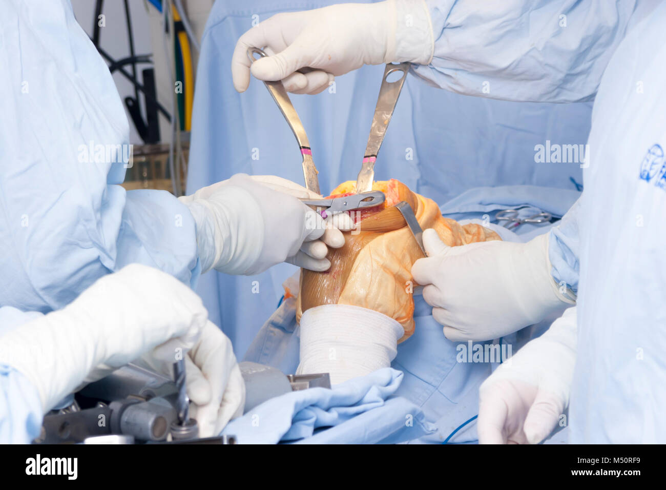 Detail of Surgery, Orthopedic Operation, Knee Surgery Stock Photo - Alamy