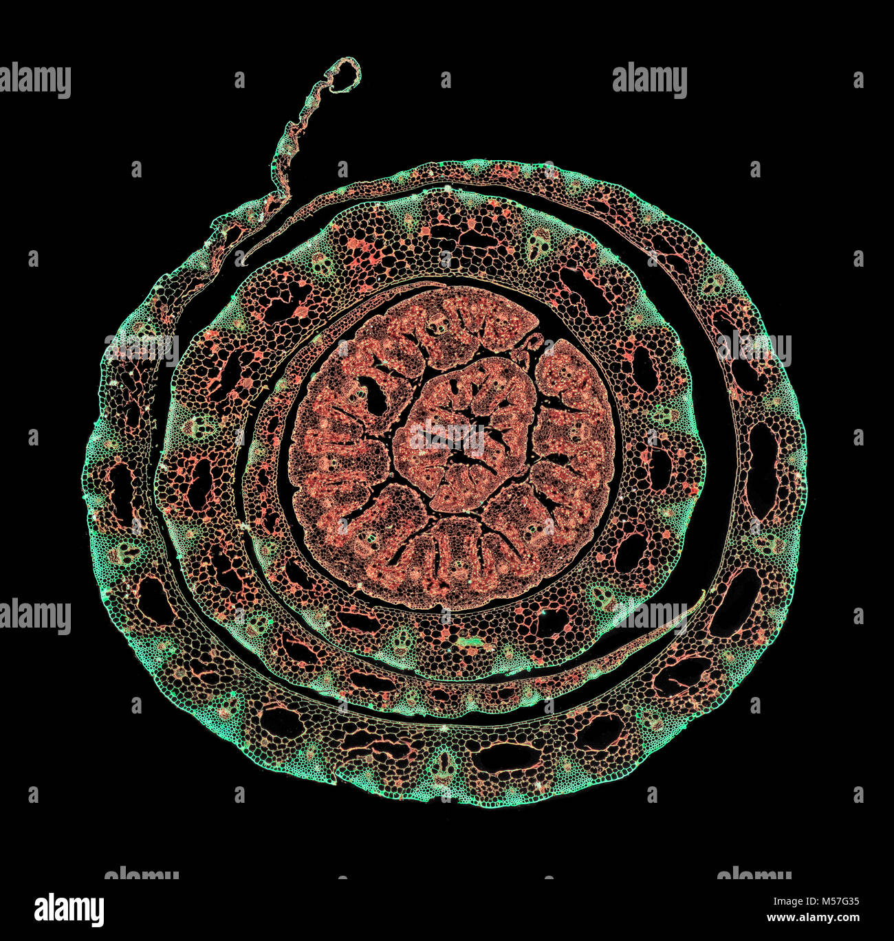 Microscope xylem phloem vascular bundles darkfield photomicrograph hi ...