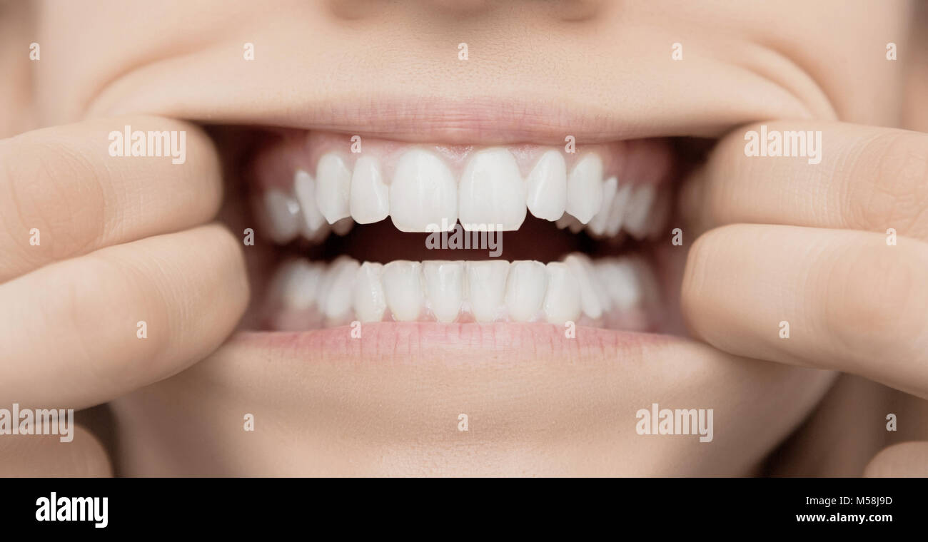 Open mouth with white tooth, dental care Stock Photo - Alamy