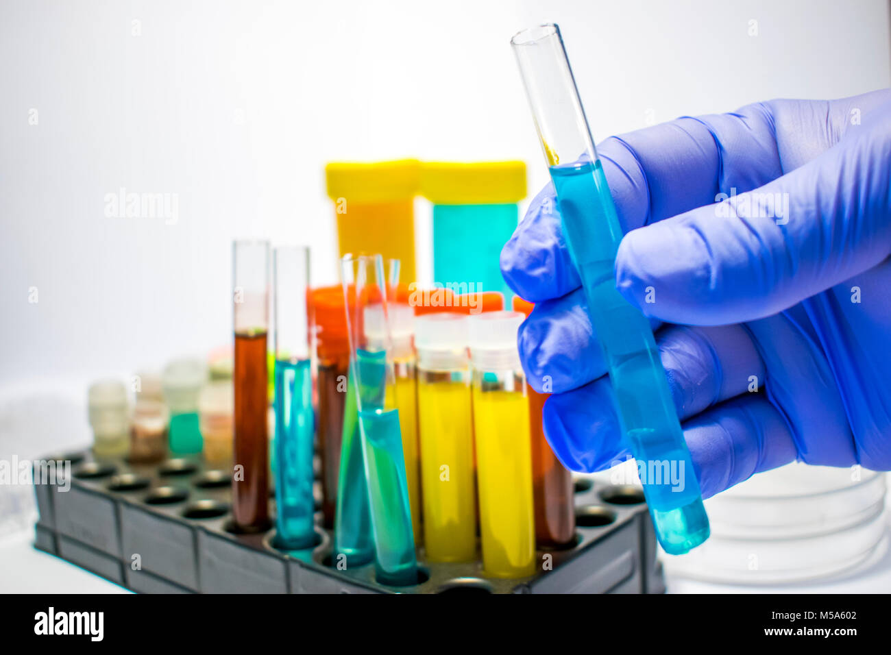 colorful laboratory test tubes, biochemistry blood tests, urine test ...