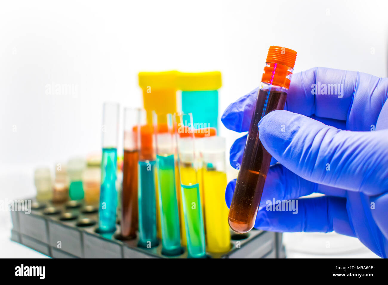 colorful laboratory test tubes, biochemistry blood tests, urine test ...