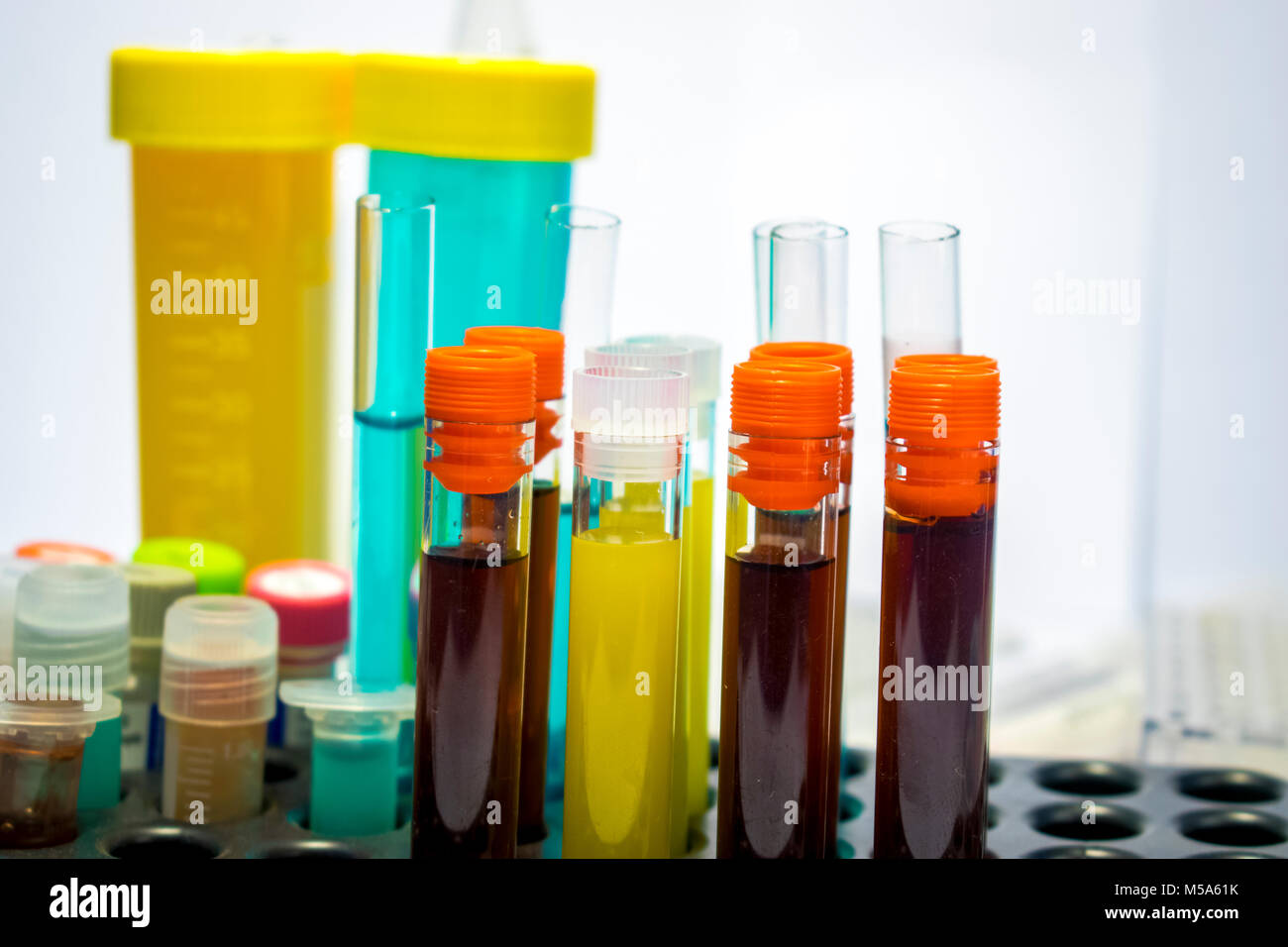 colorful laboratory test tubes, biochemistry blood tests, urine test ...