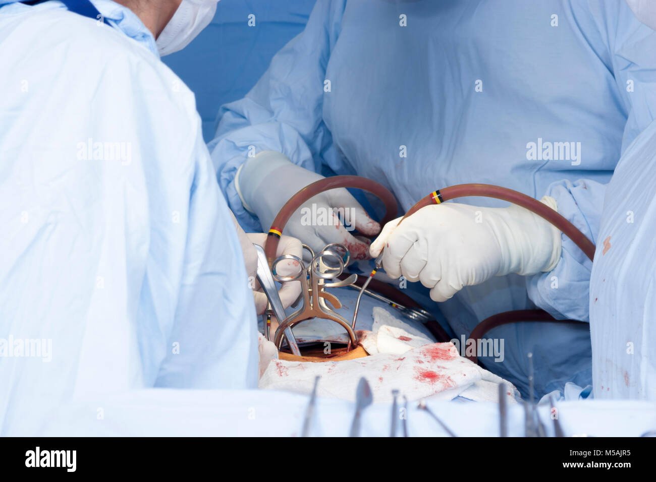 Surgical procedure in the hospital Stock Photo - Alamy