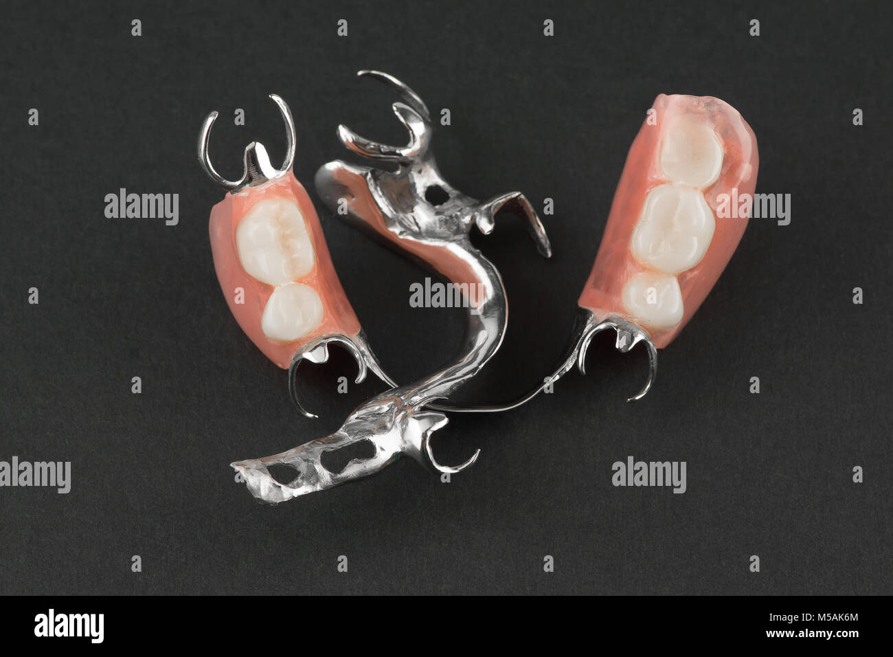 Elements of a clasp prosthesis close-up isolated on a black background ...