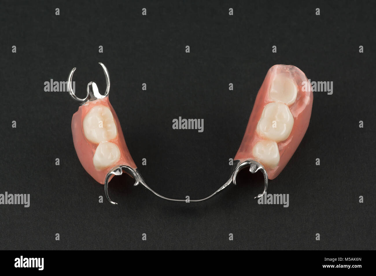 Elements of a clasp prosthesis close-up isolated on a black background ...