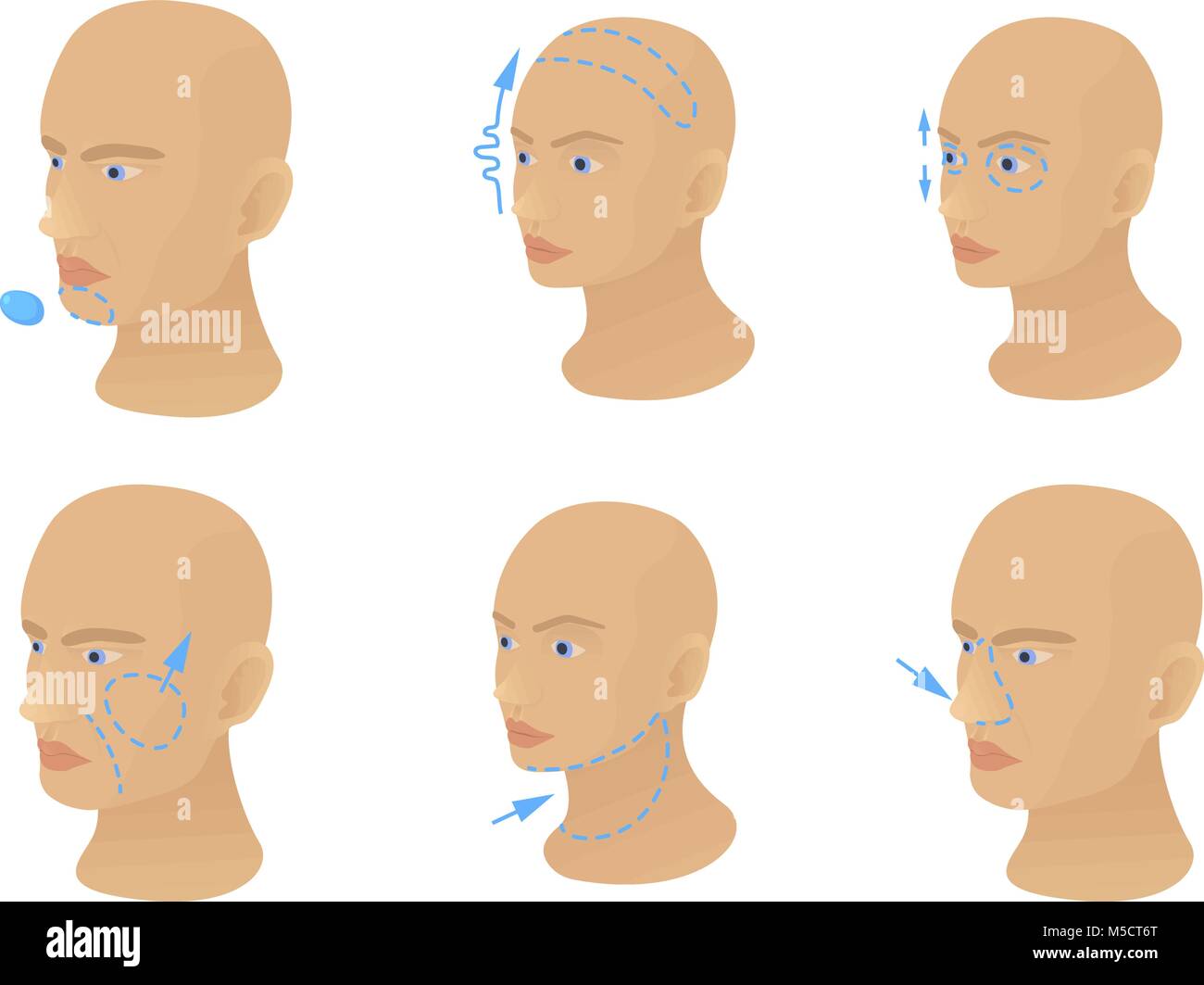 Medicaloperation Stock Vector Images - Alamy