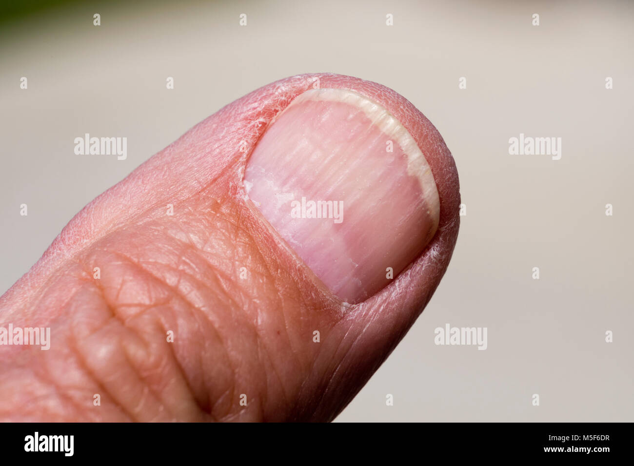 Hand and thumb hi-res stock photography and images - Alamy