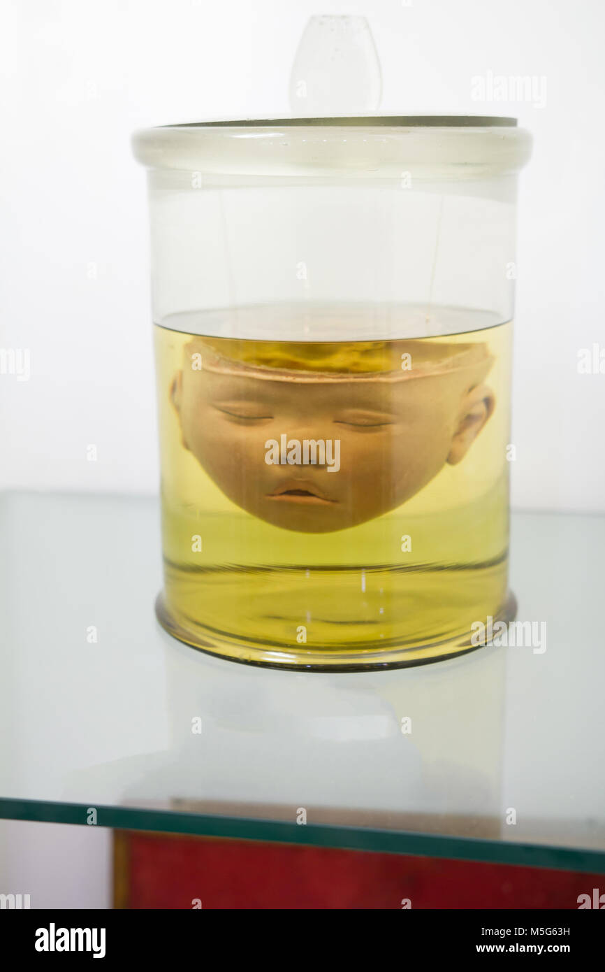 Formalin High Resolution Stock Photography and Images - Alamy