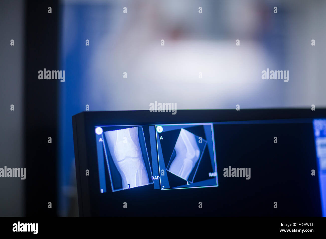 Department of radiography hi-res stock photography and images - Alamy