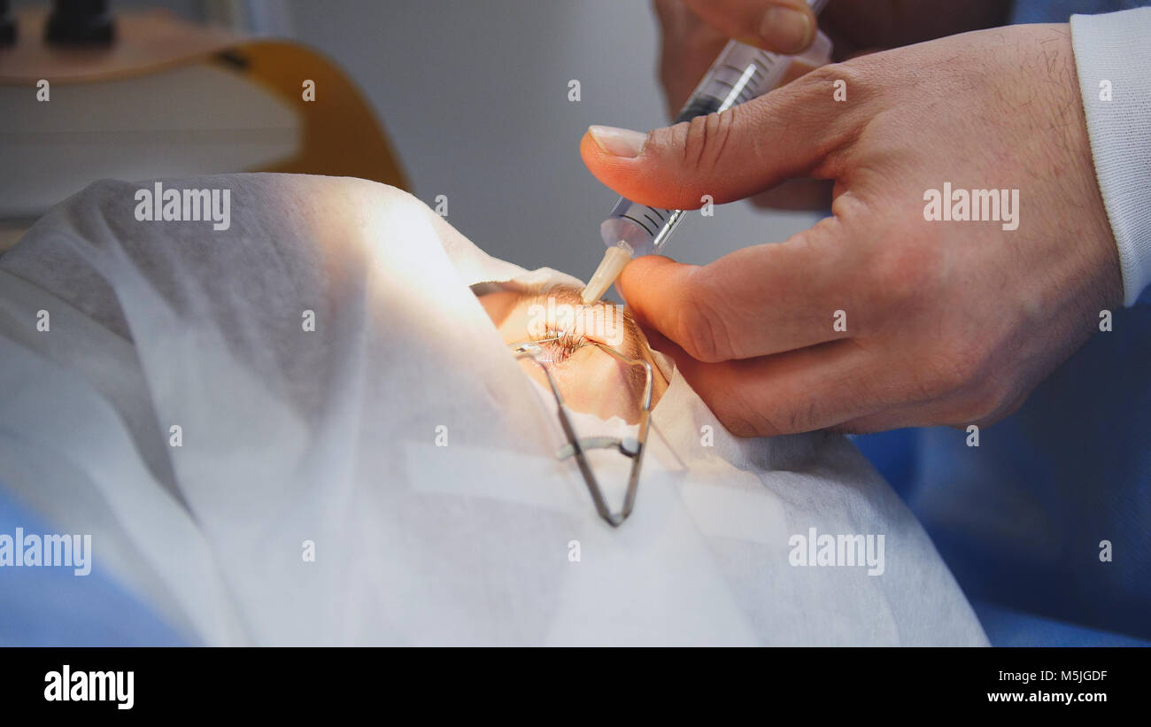 Laser correction for vision - ophthalmology surgery, doctor swab rubs ...