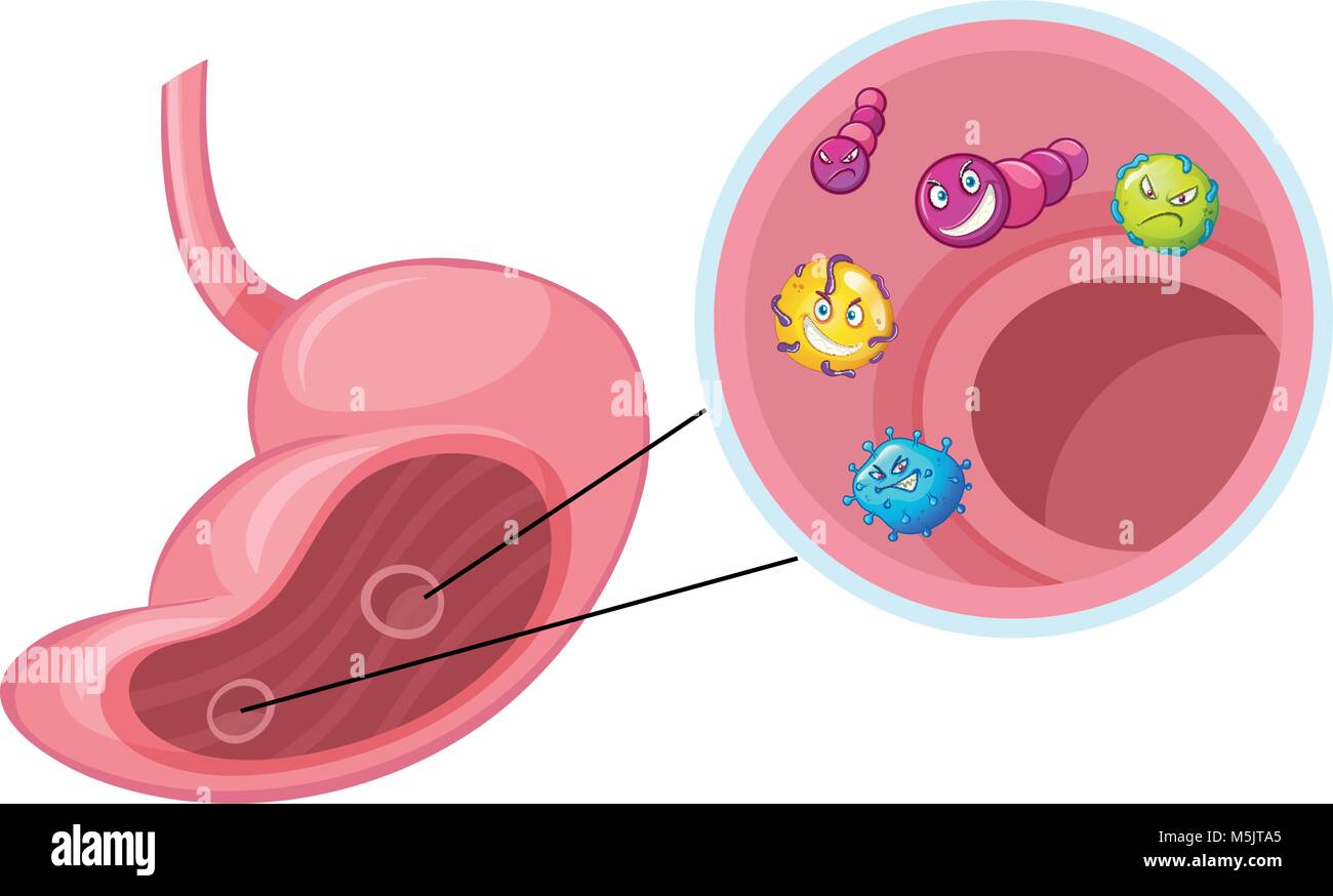 Many virus in human stomach illustration Stock Vector Image & Art - Alamy