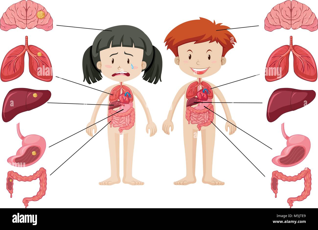 Girl and boy with different healthy and unhealthy body illustration ...