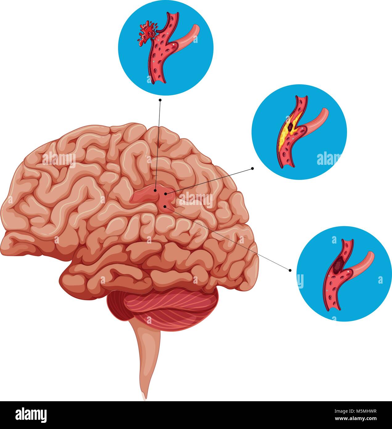 Blood Flow To The Brain Diagram Basis Of The Brain