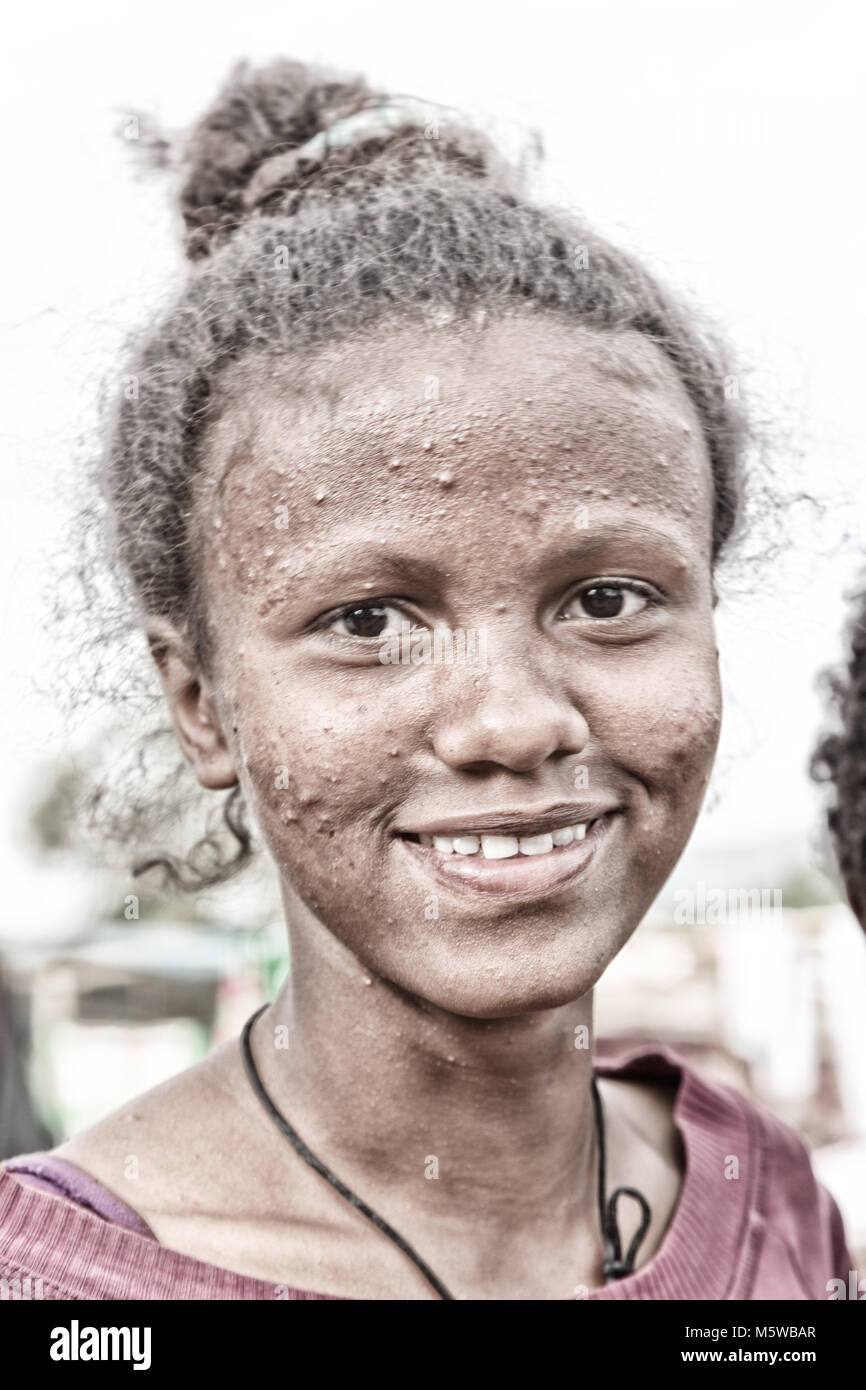 ETHIOPIA,LALIBELA-CIRCA JANUARY 2018--unidentified young girl in the ...