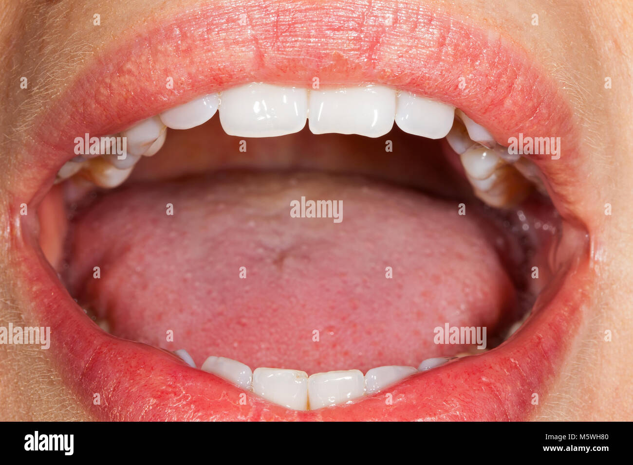 Oral cavity hi-res stock photography and images - Alamy