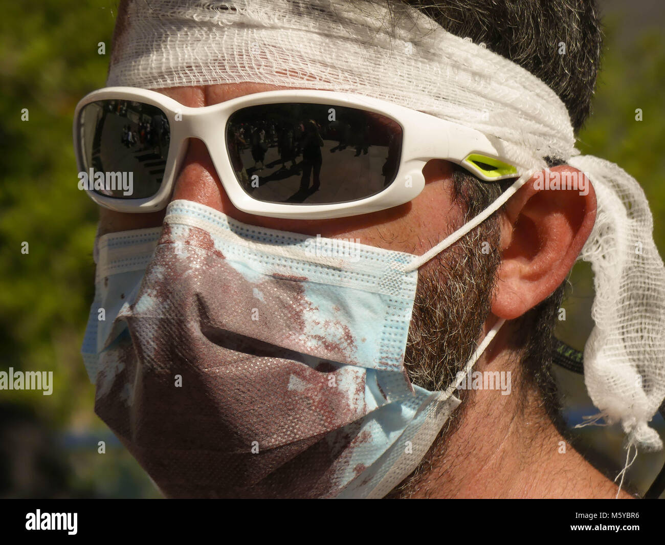Closeup young male doctor wearing medicine mask blood stained Stock ...