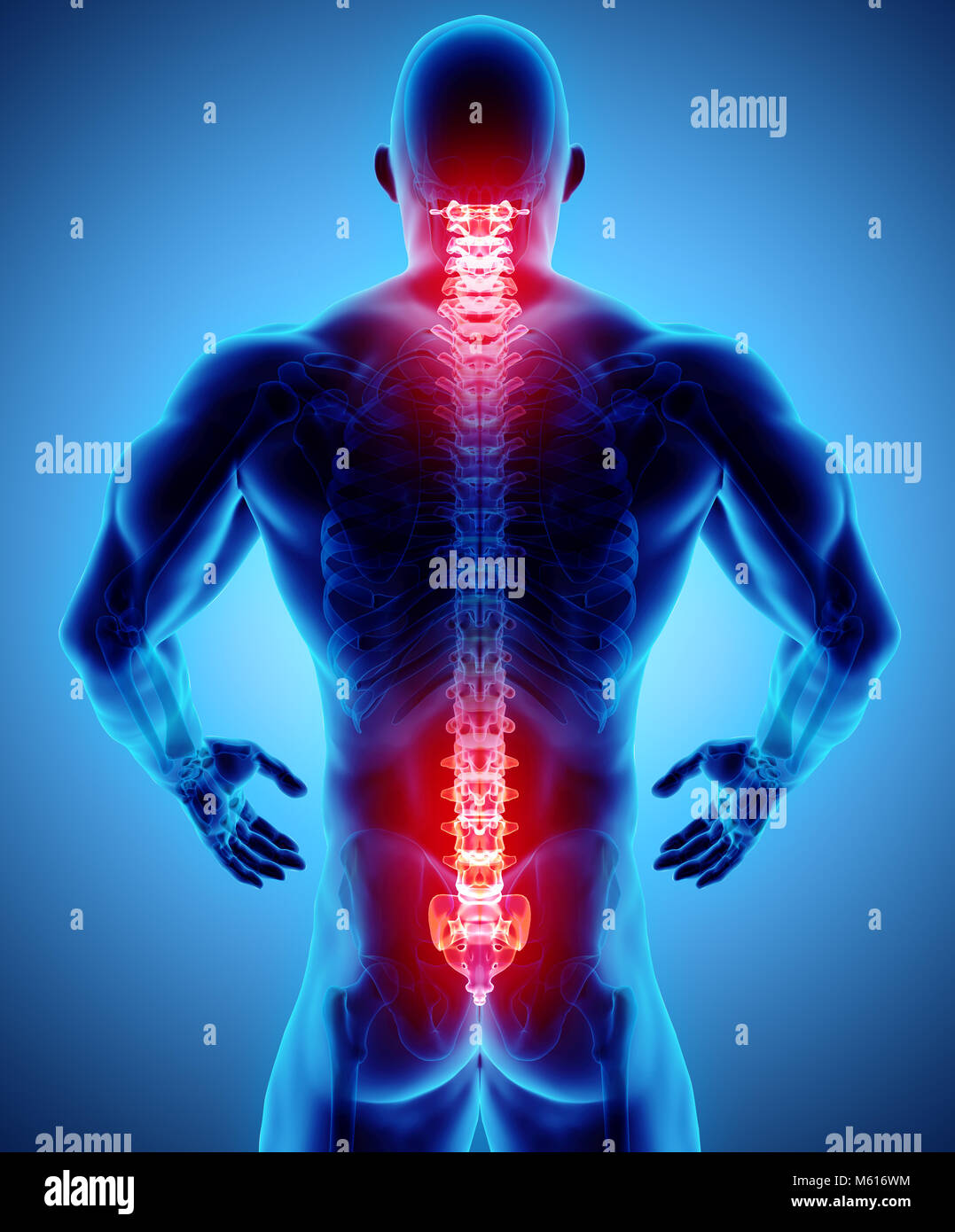 3D Illustration of sacral and cervical painful, medical concept Stock ...