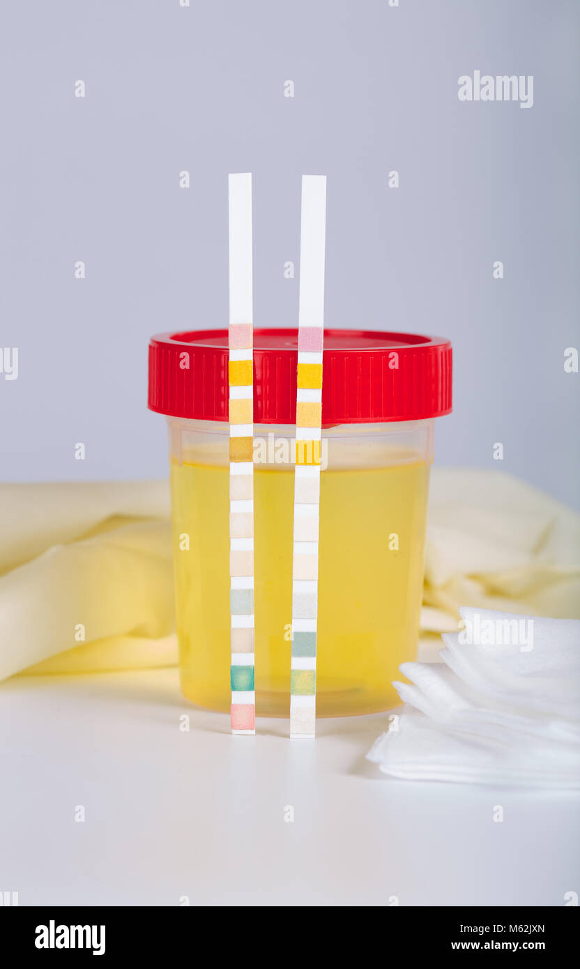 Collection cup with urine and urine test strips on a table of a lab ...