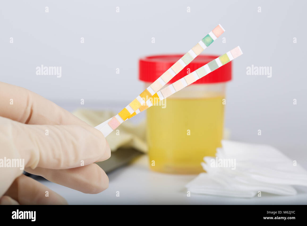 Collection cup with urine and urine test strips on a table of a lab ...