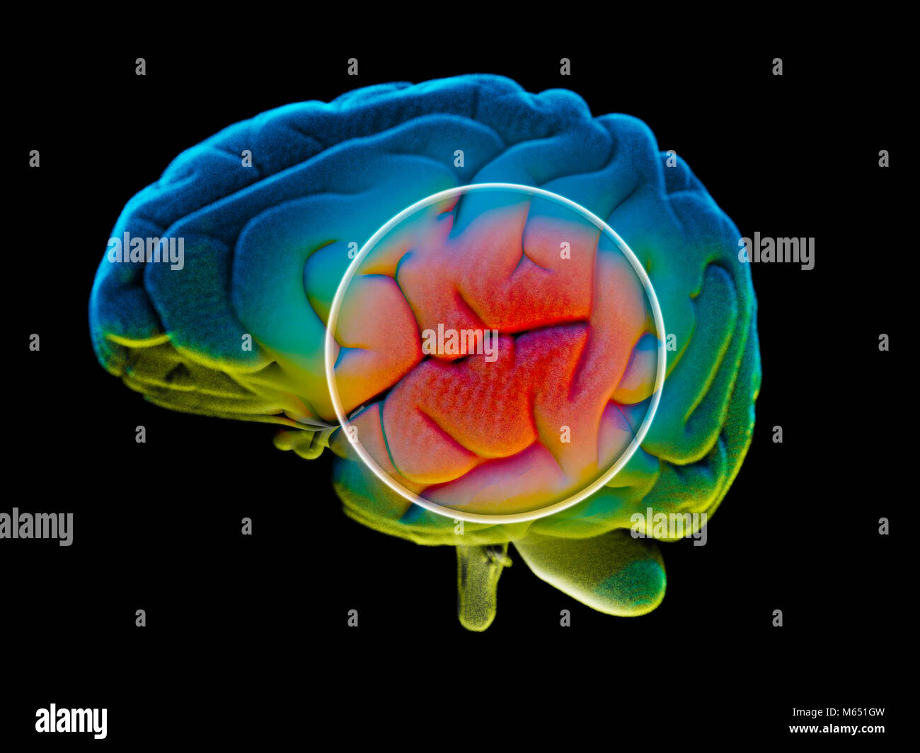 Brain degenerative diseases, Parkinson, synapses, neurons, Alzheimer's ...