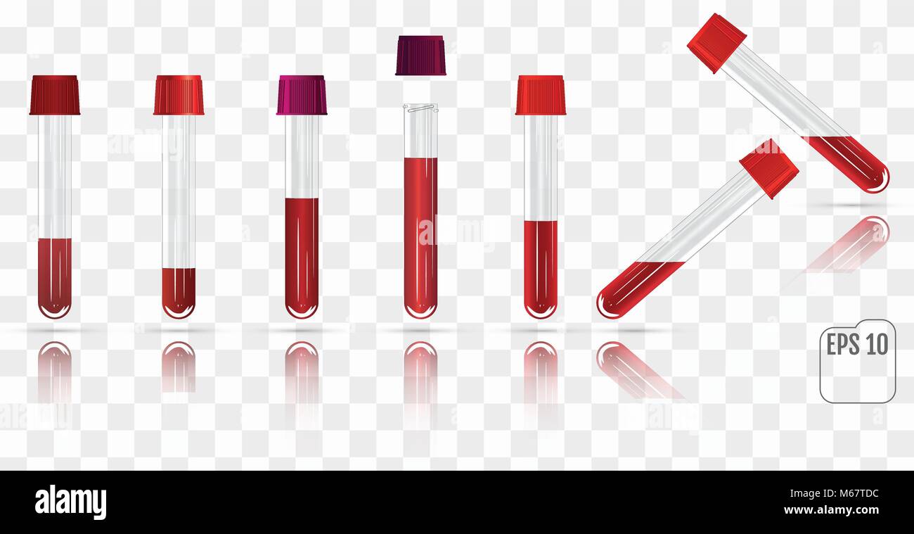 Plasma specimen Stock Vector Images - Alamy