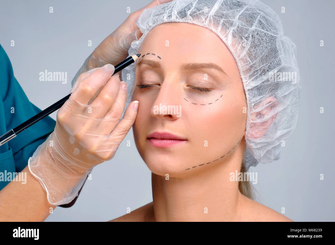 Plastic surgery. Woman with dotted lines on the face. Anti-aging ...