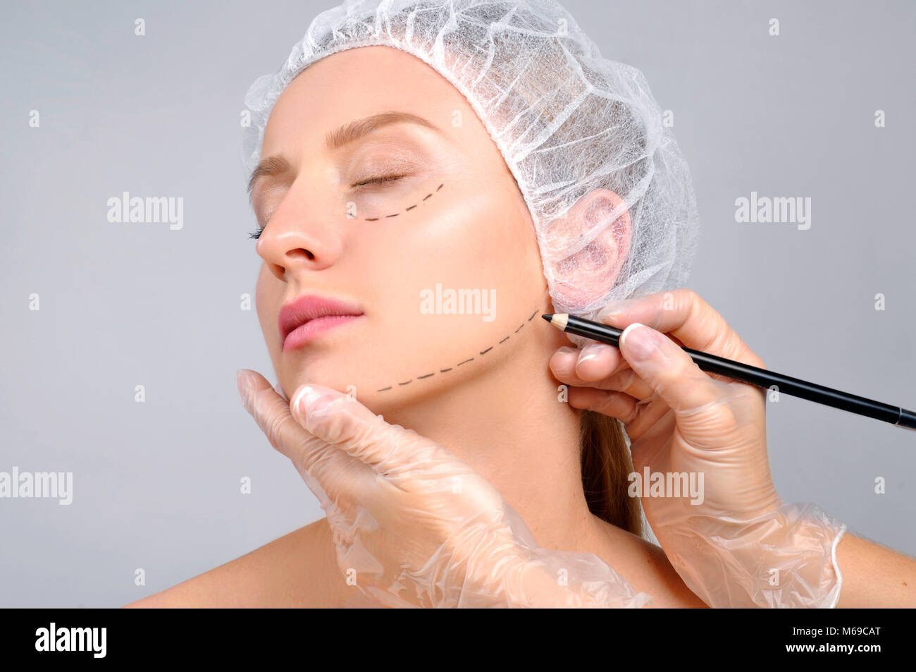 Plastic surgery. Woman with dotted lines on the face. Anti-aging ...
