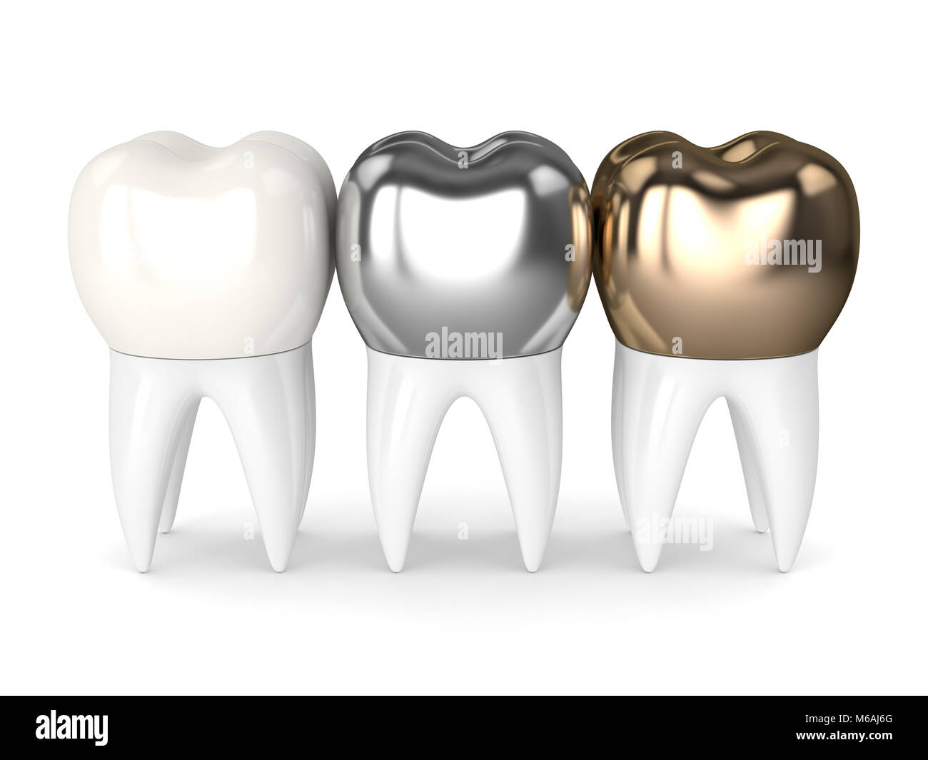 What Is The Composition Of Dental Gold at Walton Edwards blog