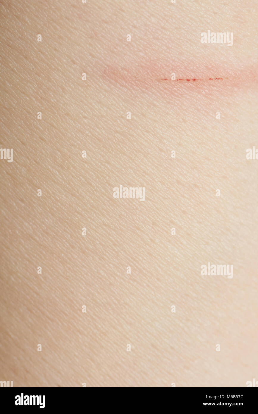 Skin effect hi-res stock photography and images - Alamy