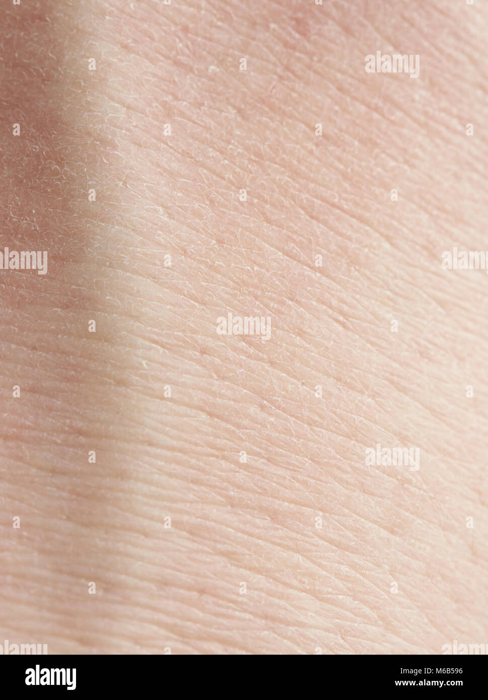 Allergic rash dermatitis skin texture hi-res stock photography and ...