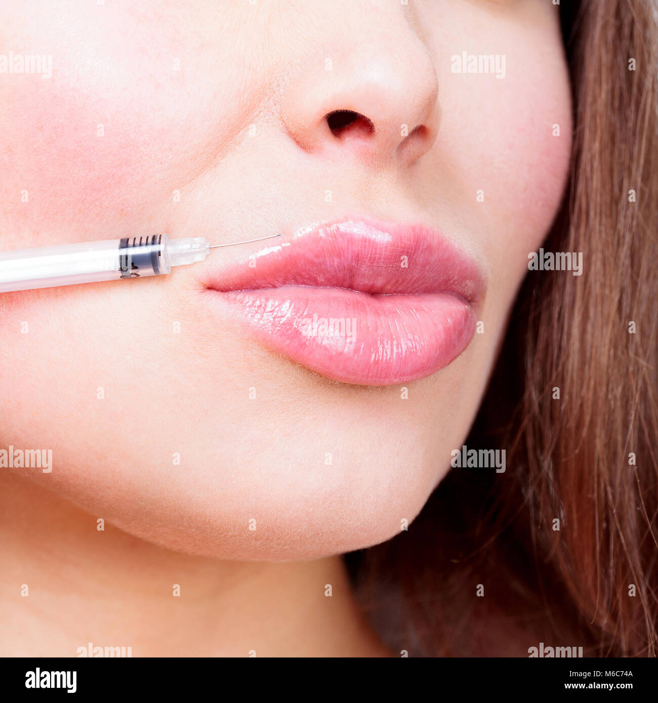 Closeup shot of beautiful female lips and syringe with filler Stock ...