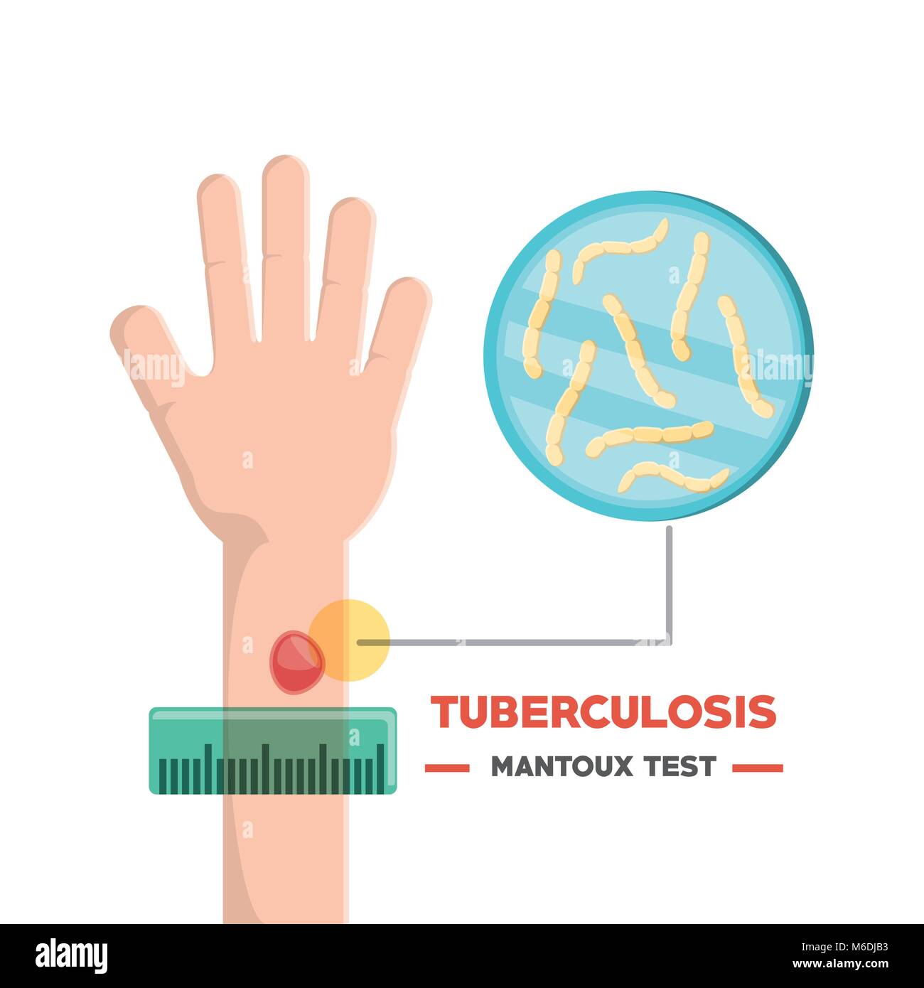 Tb Test High Resolution Stock Photography and Images - Alamy