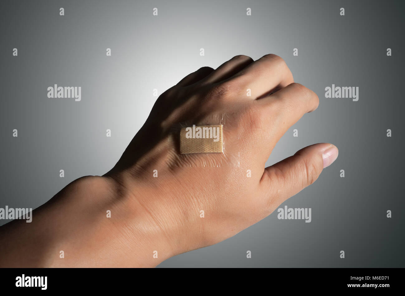 An injured hand Stock Photo - Alamy