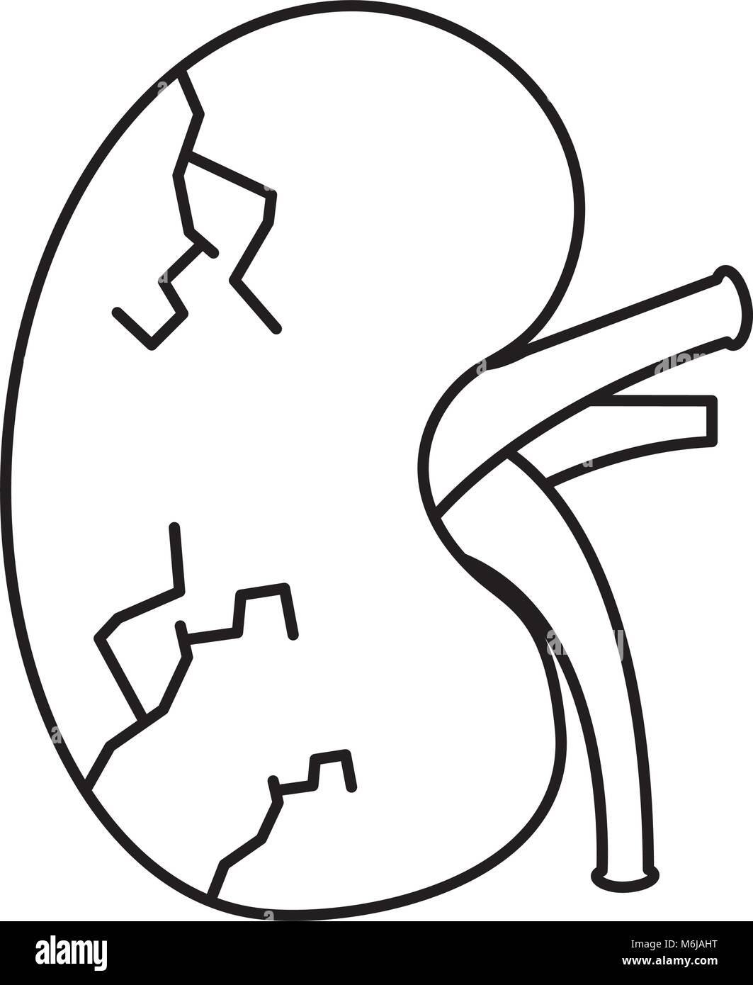 cartoon human kidney sick character Stock Vector Image & Art - Alamy