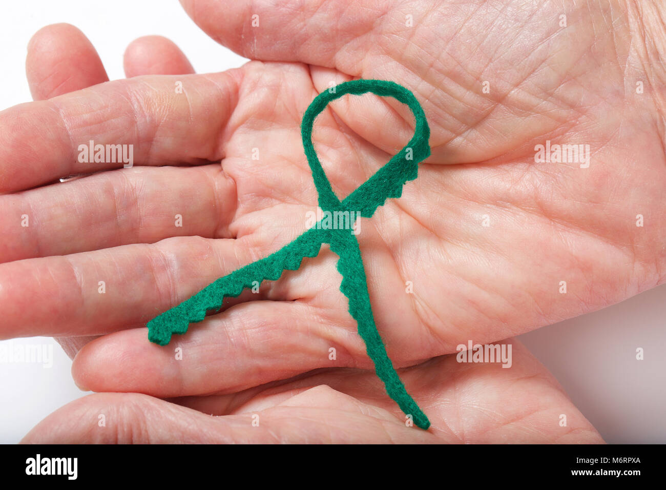 Renal cell carcinoma brain hi-res stock photography and images - Alamy