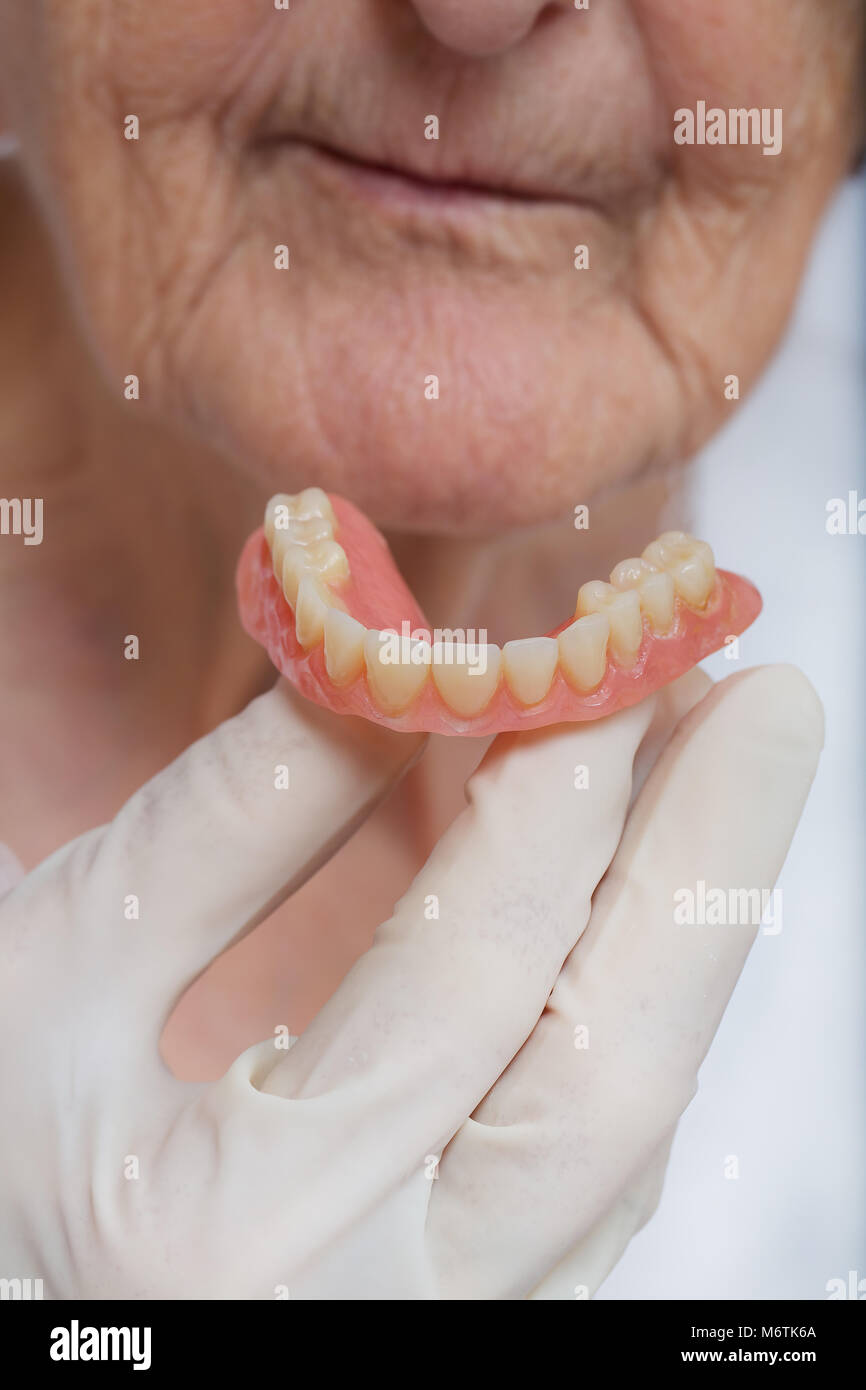 Complete denture on a stomatological table. Closeup Stock Photo - Alamy