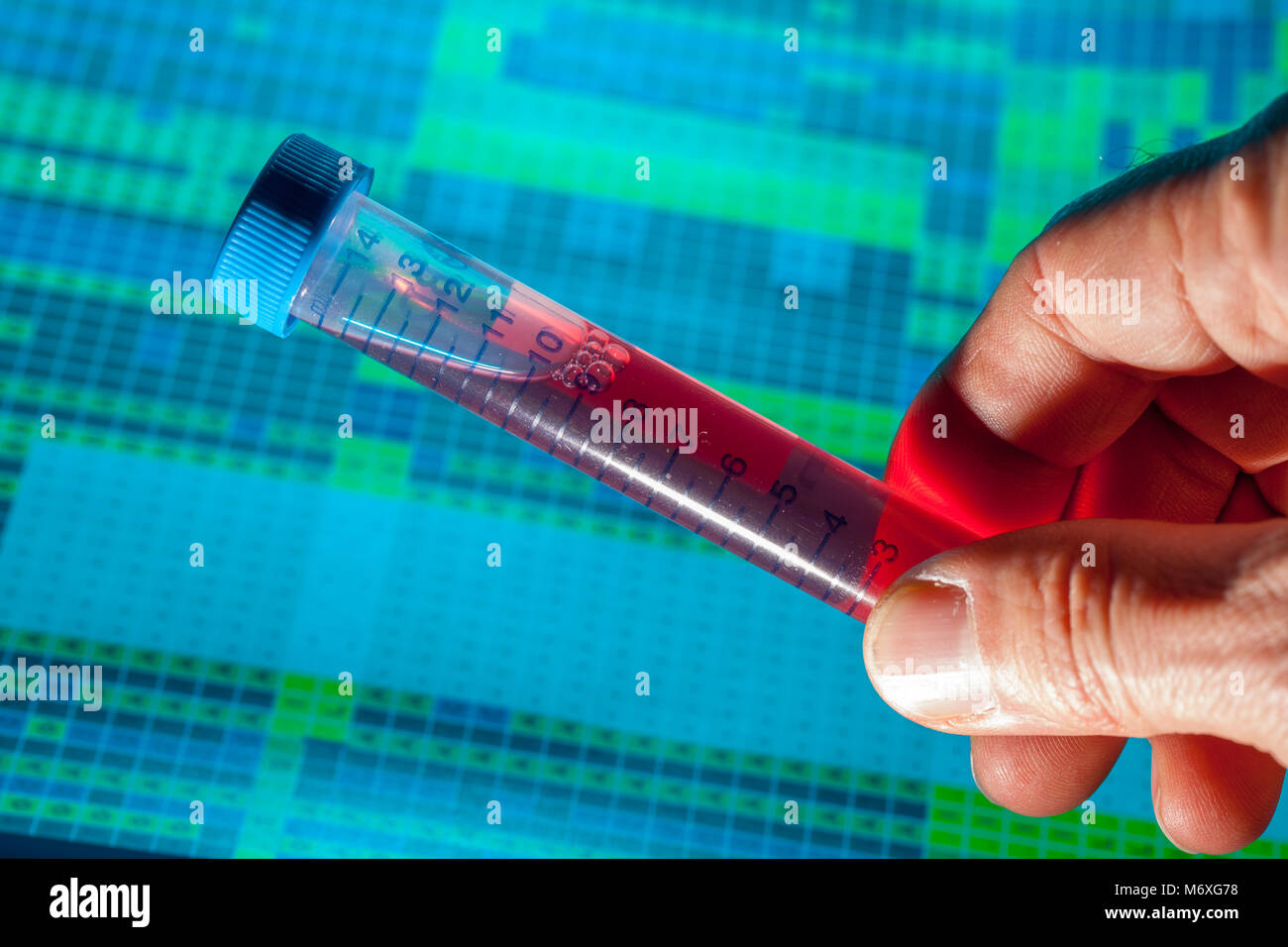 Bio samples for genetic analysis Blood In tube for laboratory analysis ...
